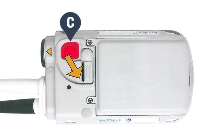 LVAD | Medocity
